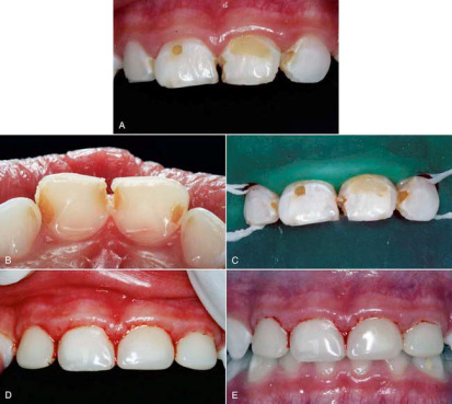 Parent info - Kids & Teens Dentistry